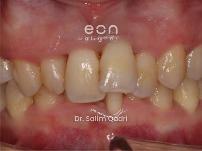 All Cases | EON Gallery