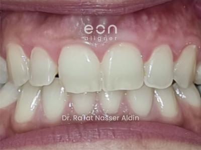 Dr. Rafat Nasser Aldin | EON Gallery