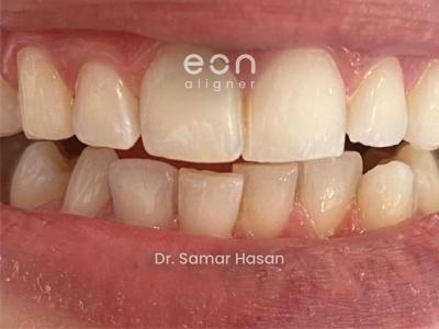 All Cases | EON Gallery