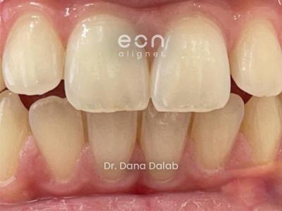 All Cases | EON Gallery