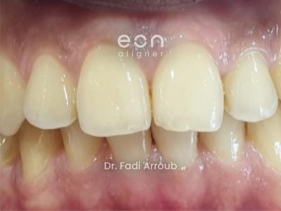 All Cases | EON Gallery