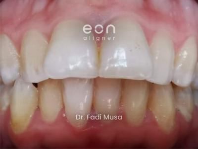 All Cases | EON Gallery