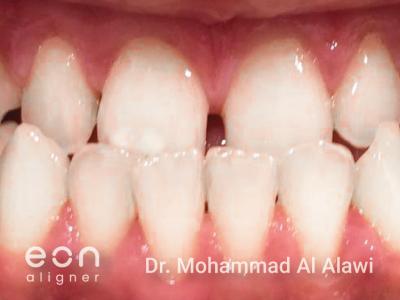 All Cases | EON Gallery