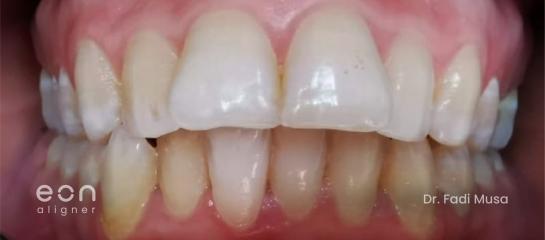 Eon Case Gallery | EON Gallery