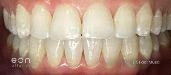 Eon Case Gallery | EON Gallery